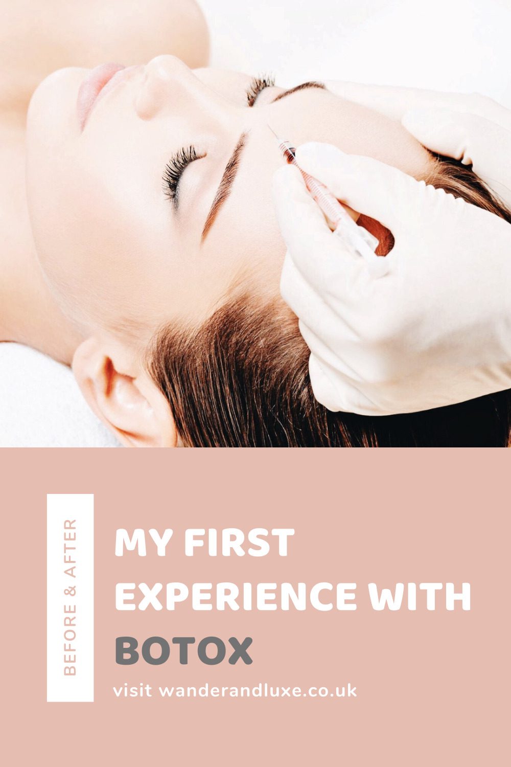 Botox Before and After: Unfiltered Photos + Honest Review